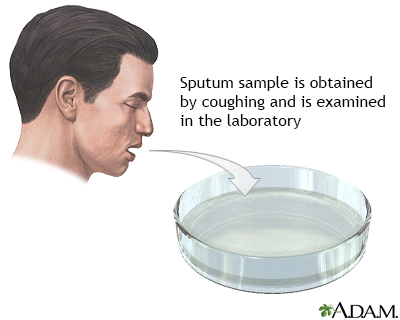 Routine sputum culture